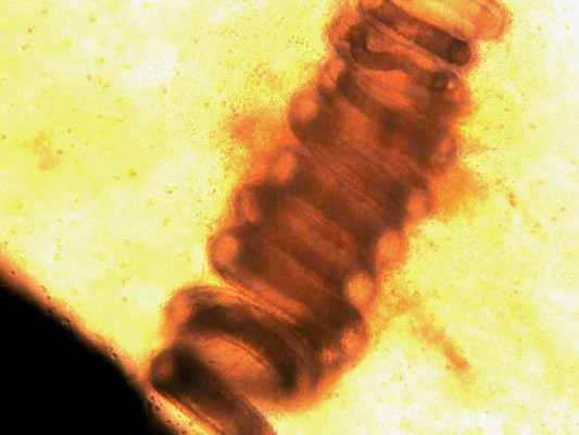 10 Common Parasites and Diseases Found in Game Fish (and What You Need ...