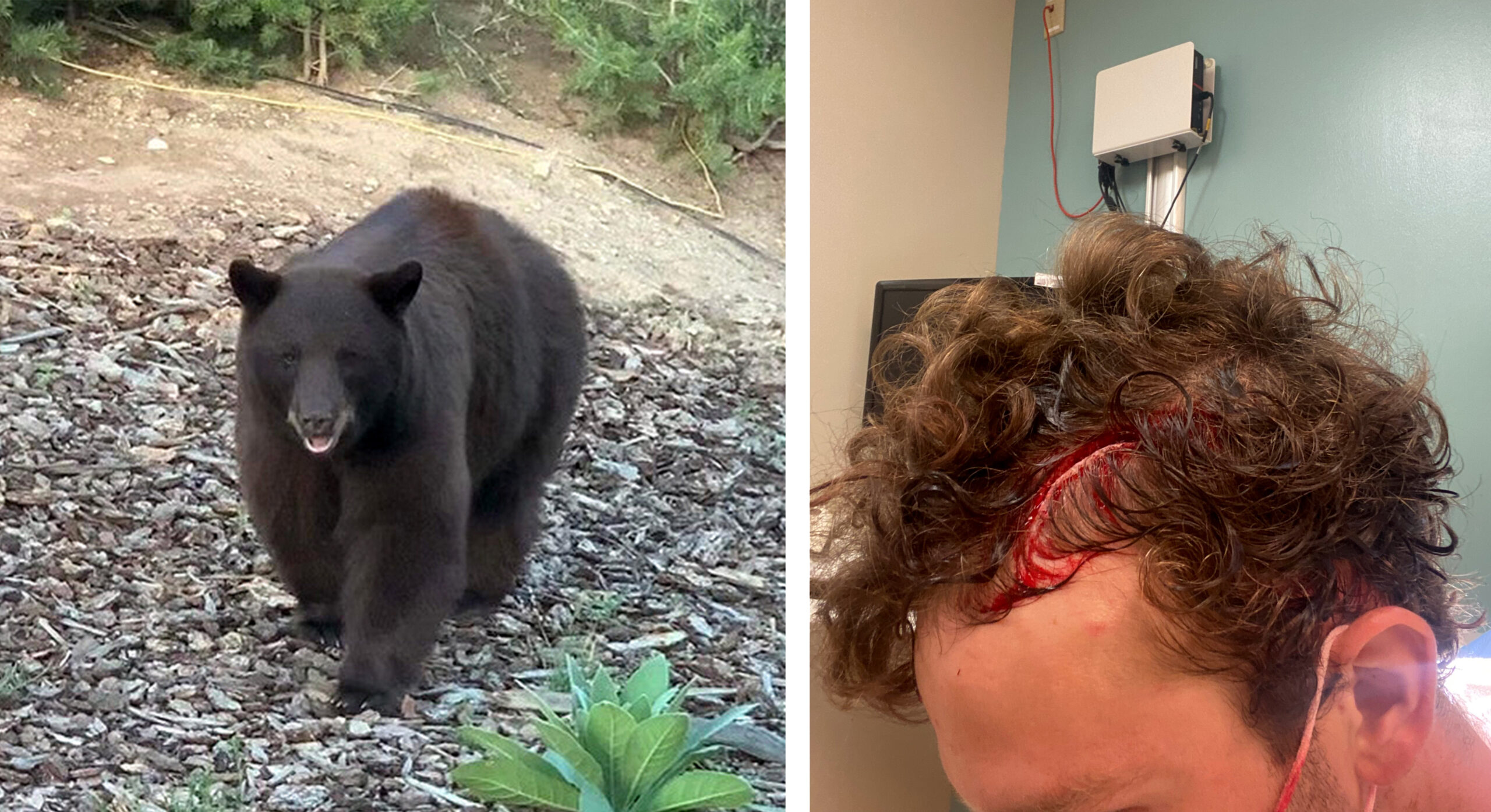 Black Bear Bites "Cowboy Camper" in the Head | Outdoor Life