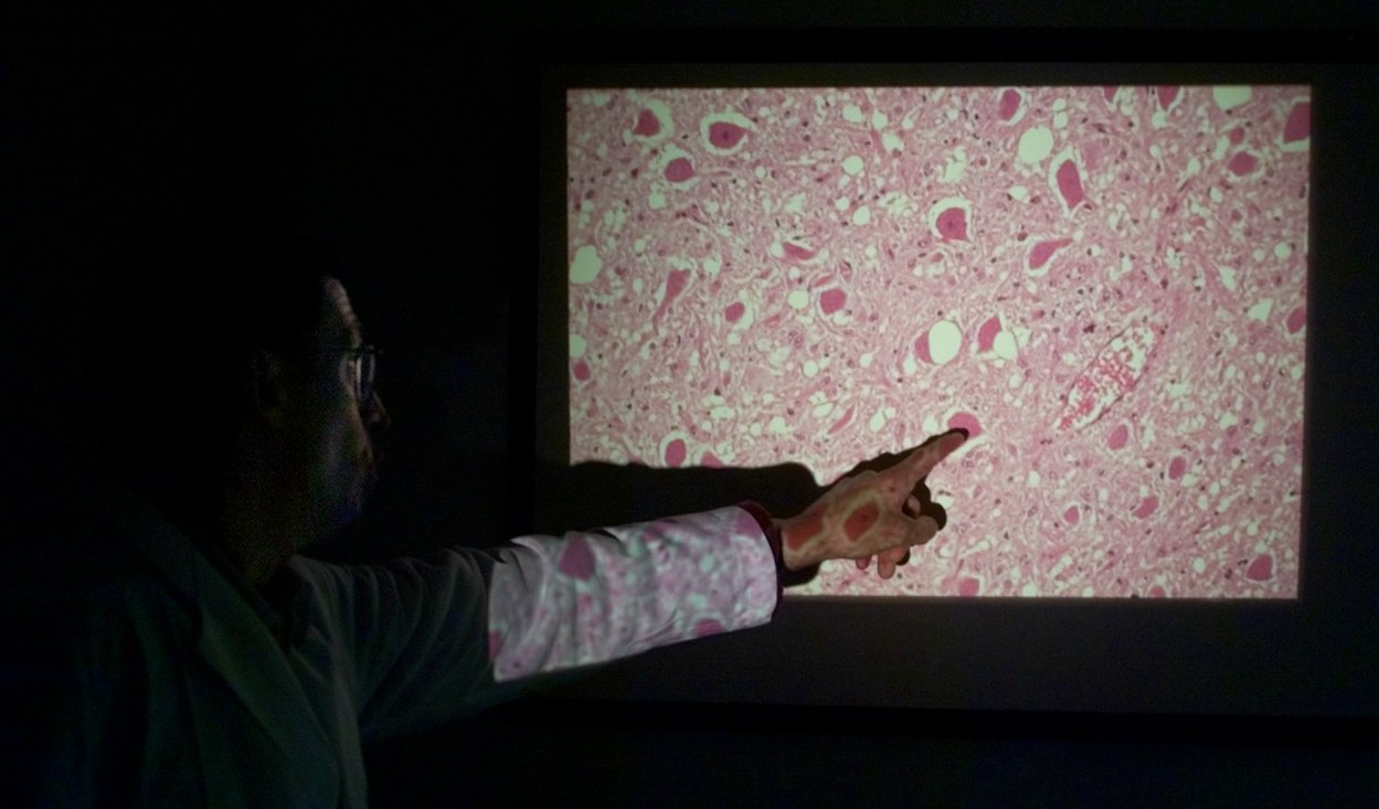 What CWD Researchers Can't Say on the Record