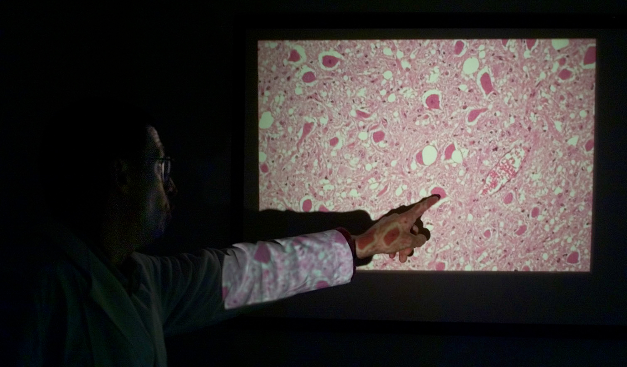 What CWD Researchers Can't Say on the Record