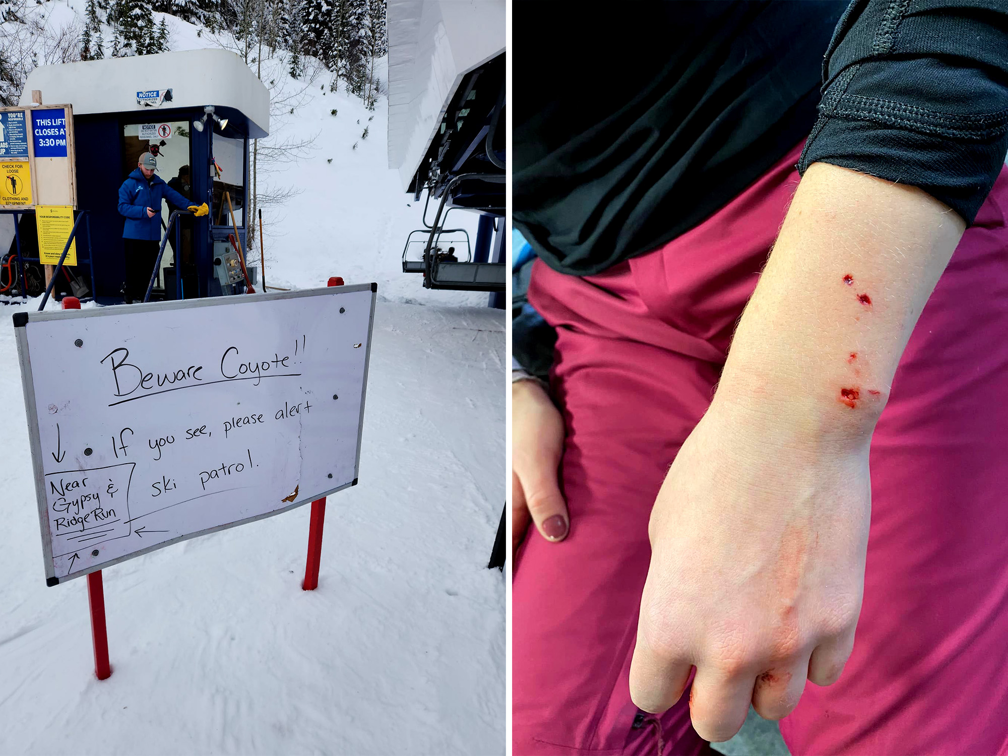 Do Coyotes Attack Humans? | Outdoor Life