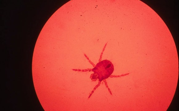 Chigger Bite Treatment | Outdoor Life