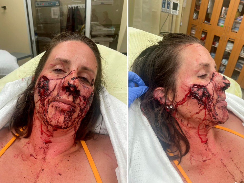 Graphic Photos of Woman Brutally Attacked by River Otter | Outdoor Life