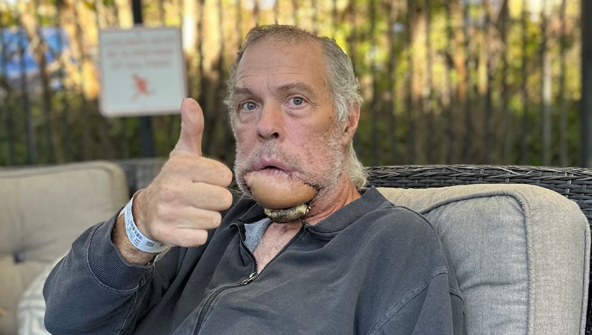 Grizzly Attack Survivor to Return Home with New Jaw | Outdoor Life