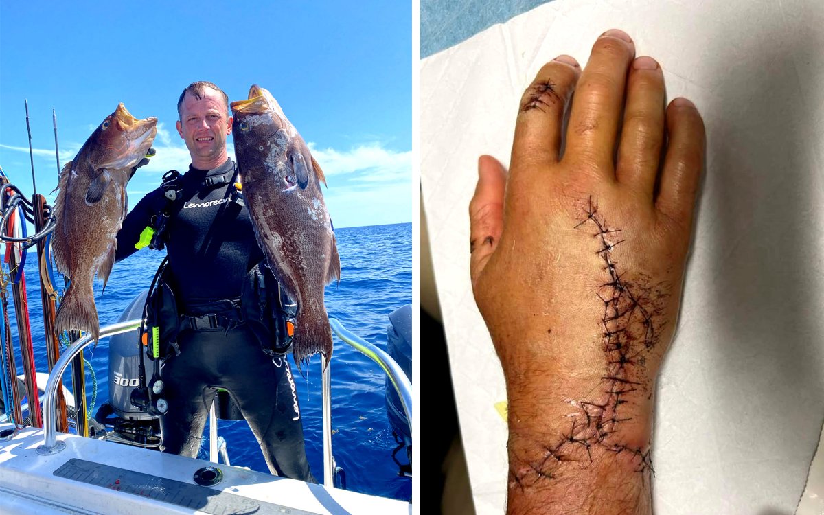 Spearfisherman Attacked by Bull Shark Says It's a 'Blessing' He Kept ...