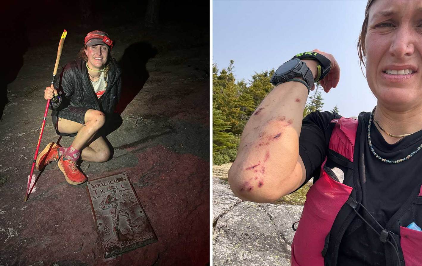 Tara Dower Battled Intense Hallucinations, Sleep Deprivation, and 53 ...