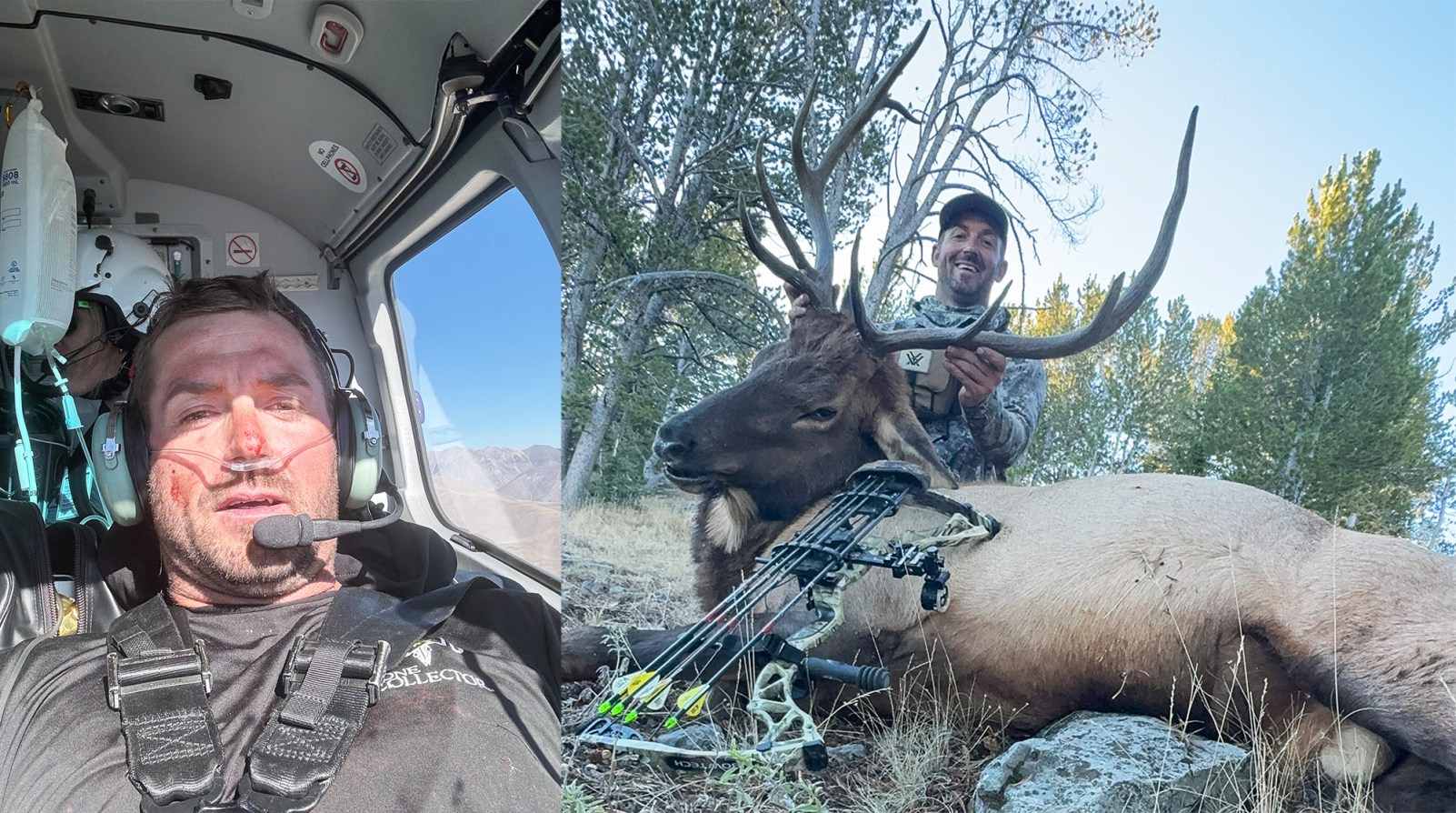 This Happened to Me: I Severed My Artery While Quartering an Elk and ...