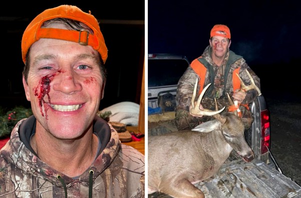 I Almost Lost My Eye While Wrestling a Buck | Outdoor Life